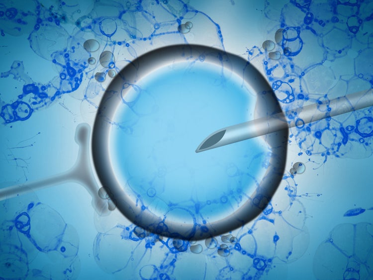 New Assisted Reproductive Technology (ART) laws in QLD and the ACT - Avant